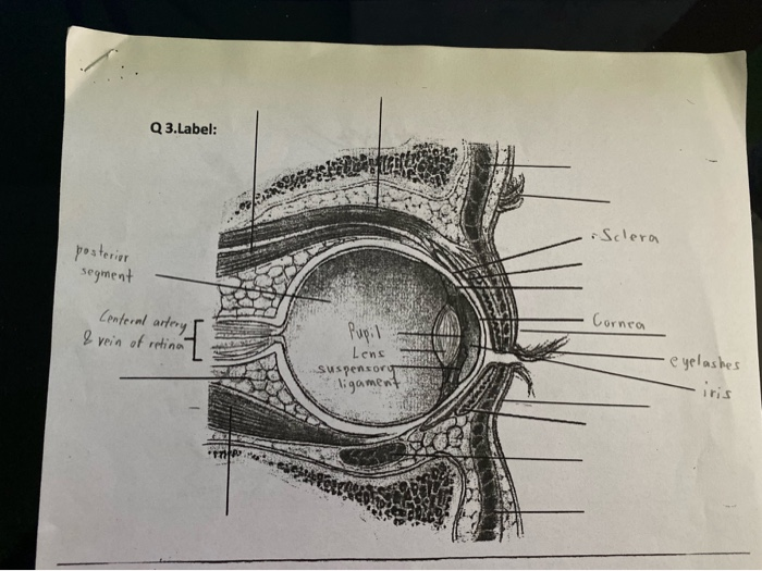 Q 3.Label: Sclera posterier segment Cornra Lenteral | Chegg.com