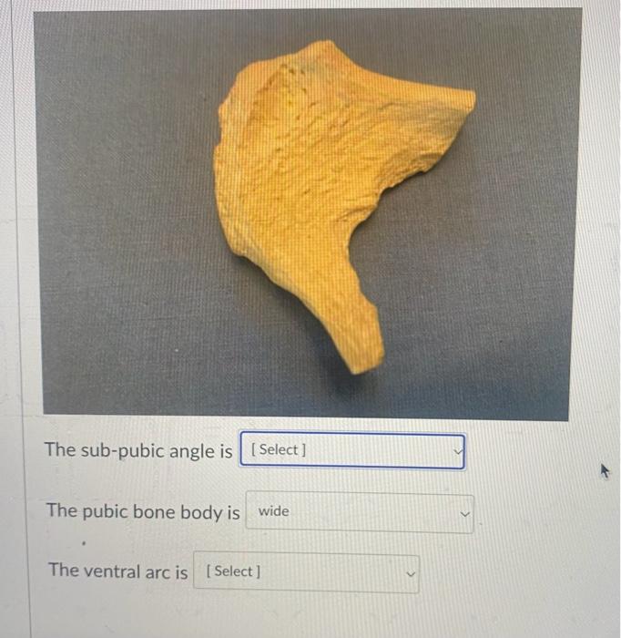 The subpubic angle is? Wide or narrow?The pubic bone | Chegg.com
