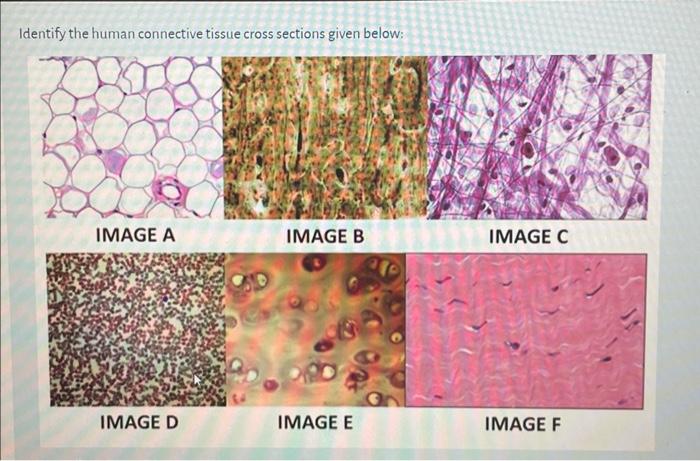 Solved Identifu the human connective tissue cross sections | Chegg.com