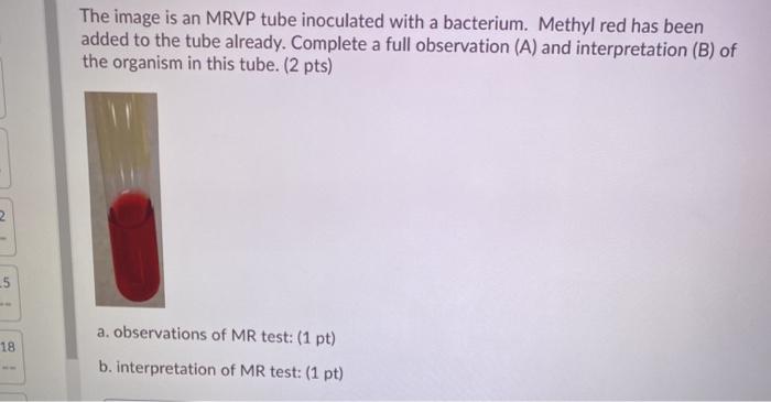 Solved The image is an MRVP tube inoculated with a | Chegg.com