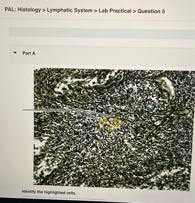 Solved PAL: Histology > Lymphatic System > Lab Practical > | Chegg.com