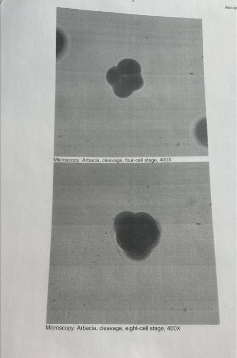 Solved Microscopy: Arbacia, cleavage, two-cell stage, | Chegg.com