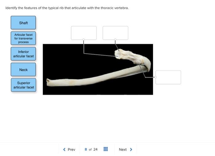 Solved Identify the features of the typical rib that | Chegg.com
