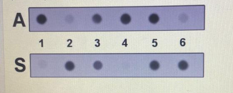 Solved 42. ﻿Use the image for ASO analysis. If the letter A | Chegg.com