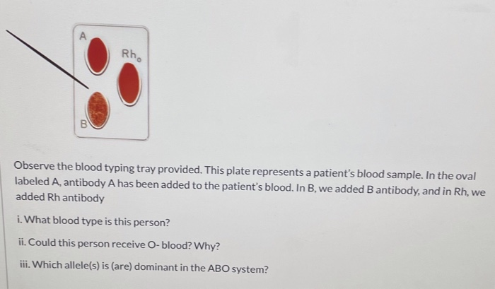Solved Rho Observe the blood typing tray provided. This | Chegg.com