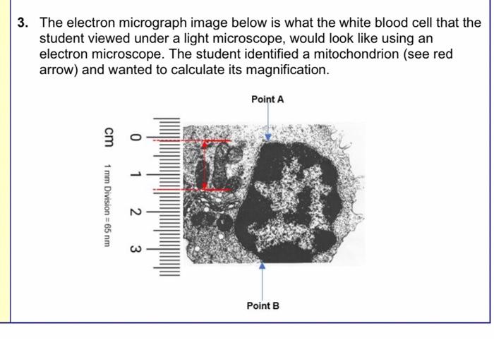 Solved The electron micrograph image below is what the white | Chegg.com