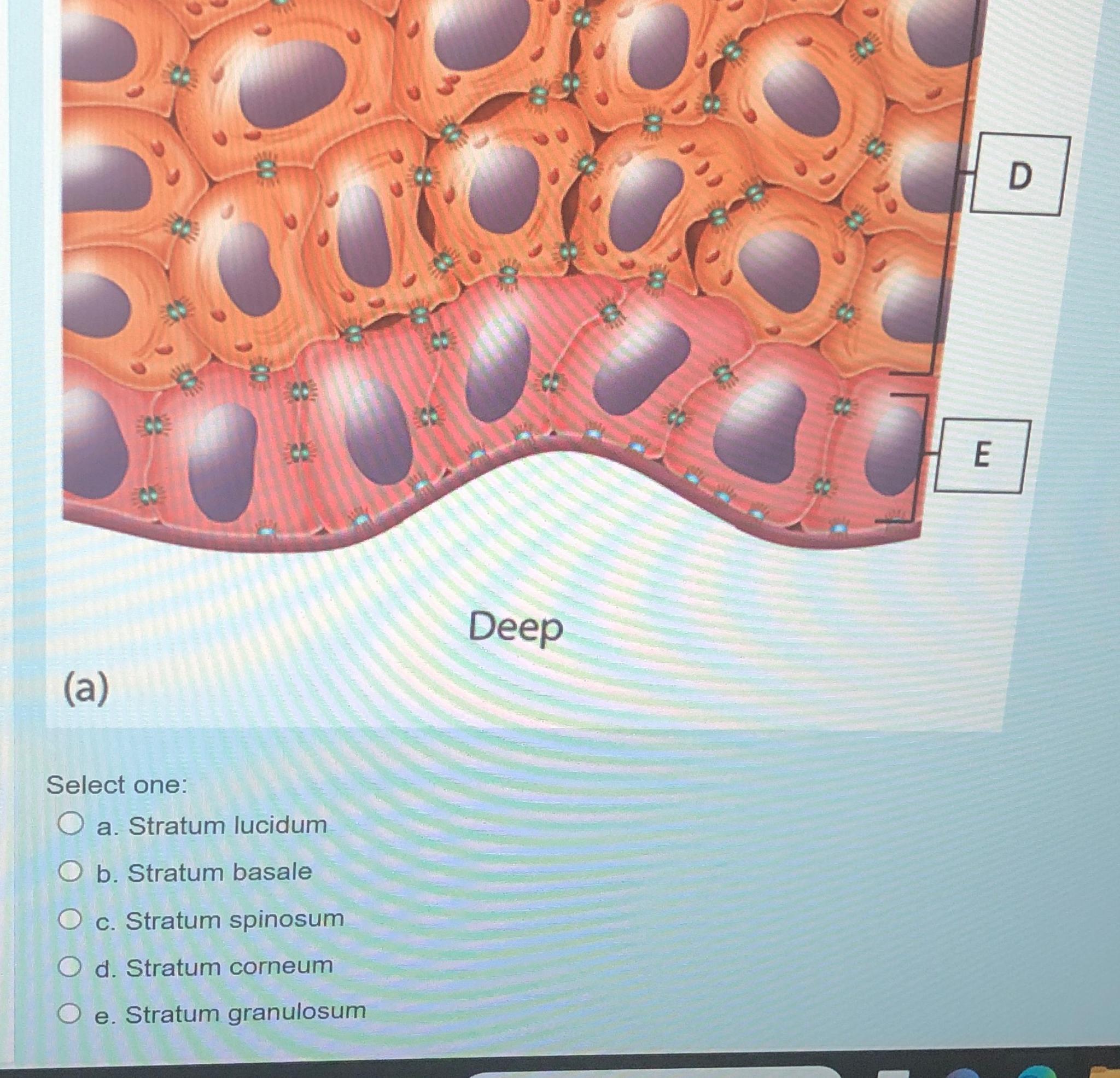 Solved (a)Select one:a. ﻿Stratum lucidumb. ﻿Stratum basalec. | Chegg.com
