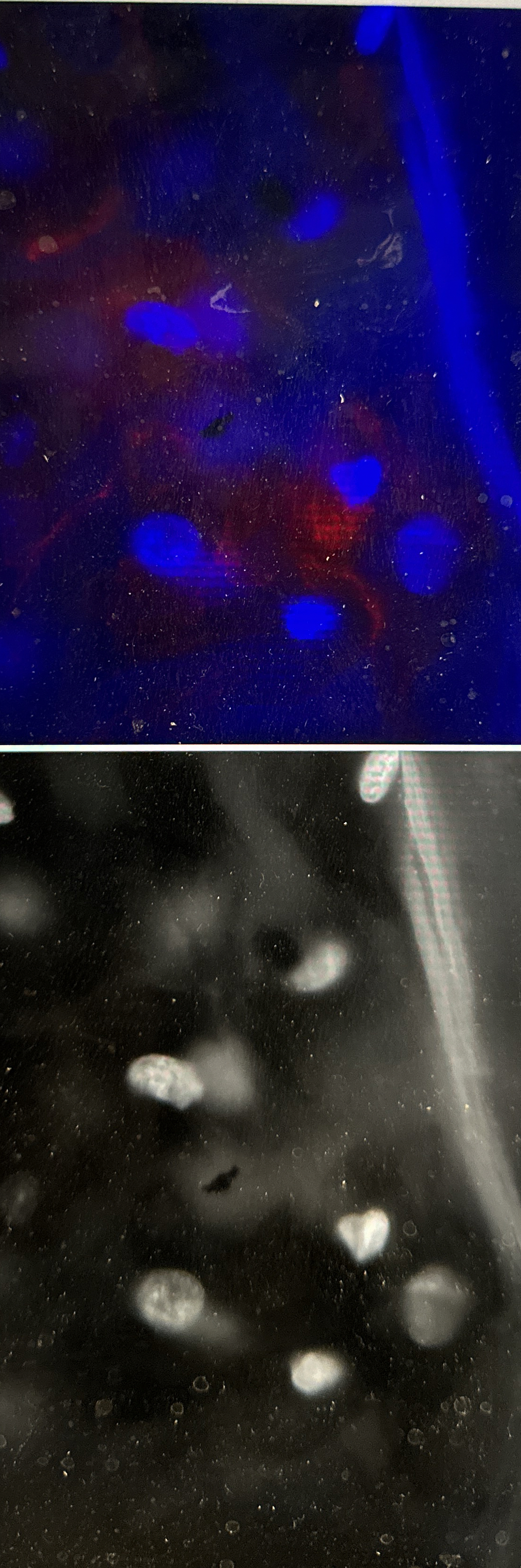 Solved Which one is microridge and exocytosis or endocytosis | Chegg.com