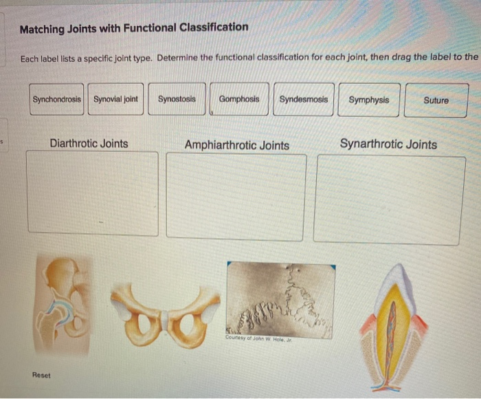 Solved Matching Joints With Functional Classification Each Chegg solved-matching-joints-with-functional-classification-each-chegg