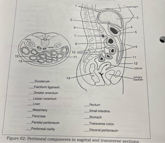 Solved _ Duodenum Falciform ligament _ Greater omentum | Chegg.com