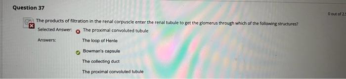 Solved Which of the following MOST accurately describes | Chegg.com