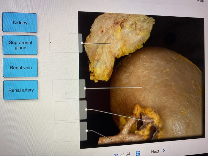 Solved Help Kidney Suprarenal gland Renal vein Renal artery | Chegg.com
