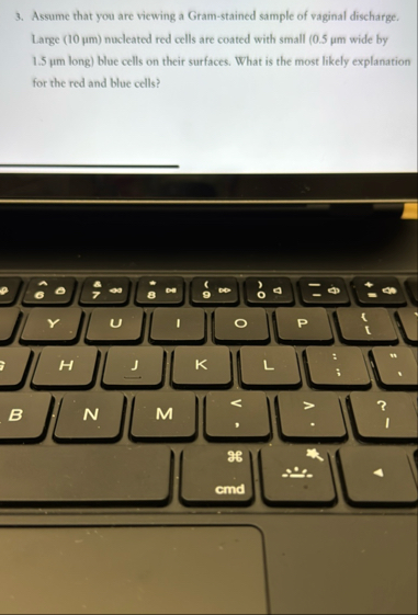 Solved Assume that you are viewing a Gram-stained sample of | Chegg.com