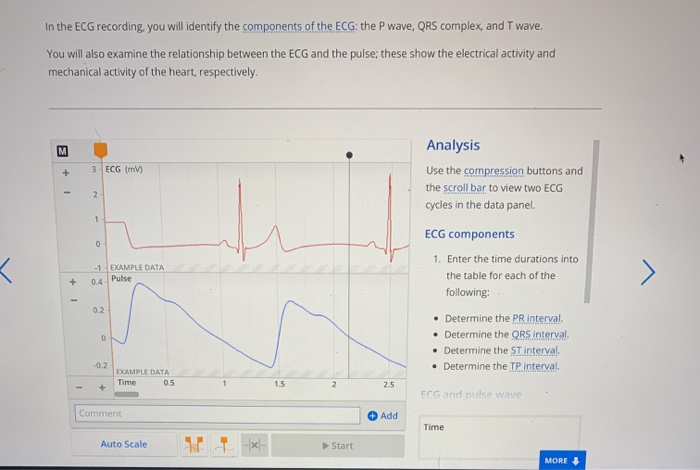Solved In the ECG recording, you will identify the | Chegg.com