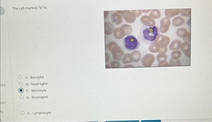 Solved The cell marked "b" 15: A. Basophil B. Neutrophill C. | Chegg.com