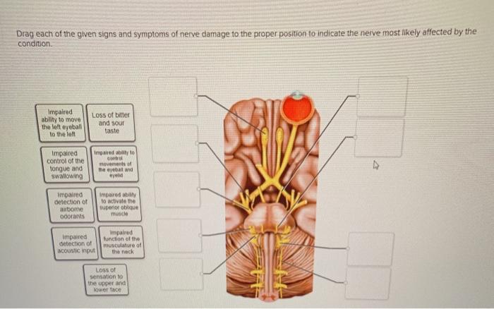 Solved Drag each of the given signs and symptoms of nerve | Chegg.com