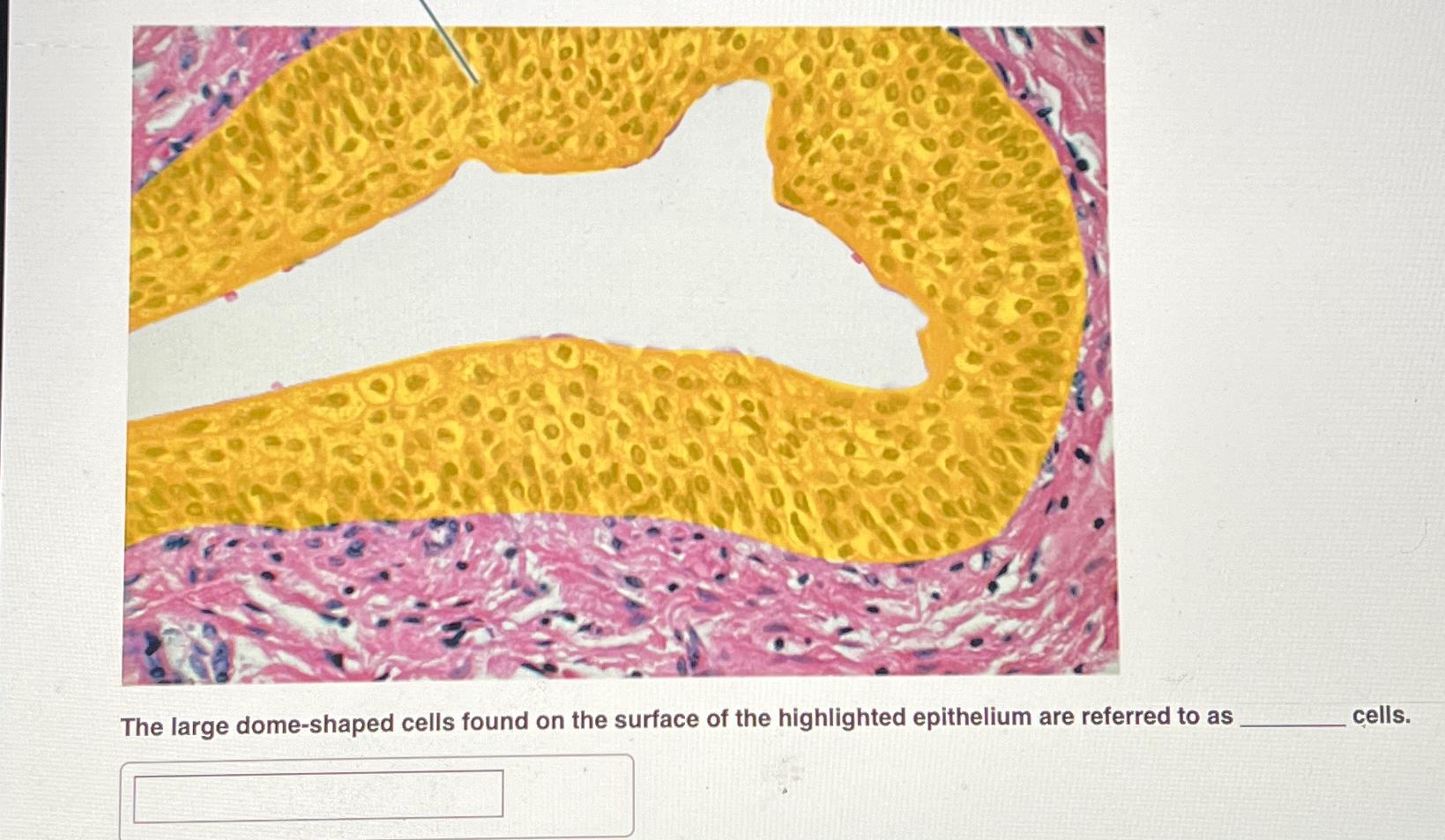 Solved The large dome-shaped cells found on the surface of | Chegg.com