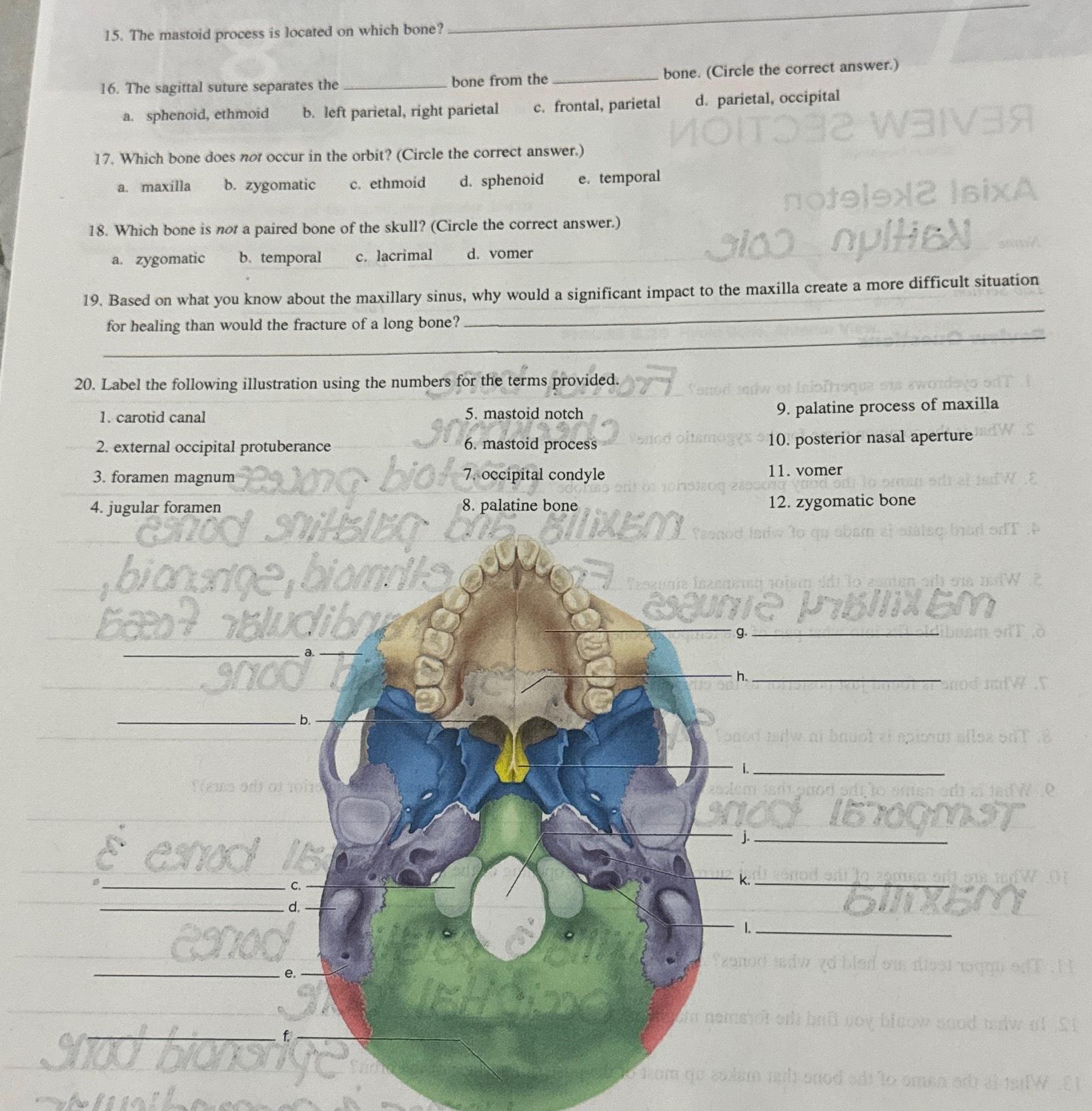 Solved The mastoid process is located on which bone?The | Chegg.com