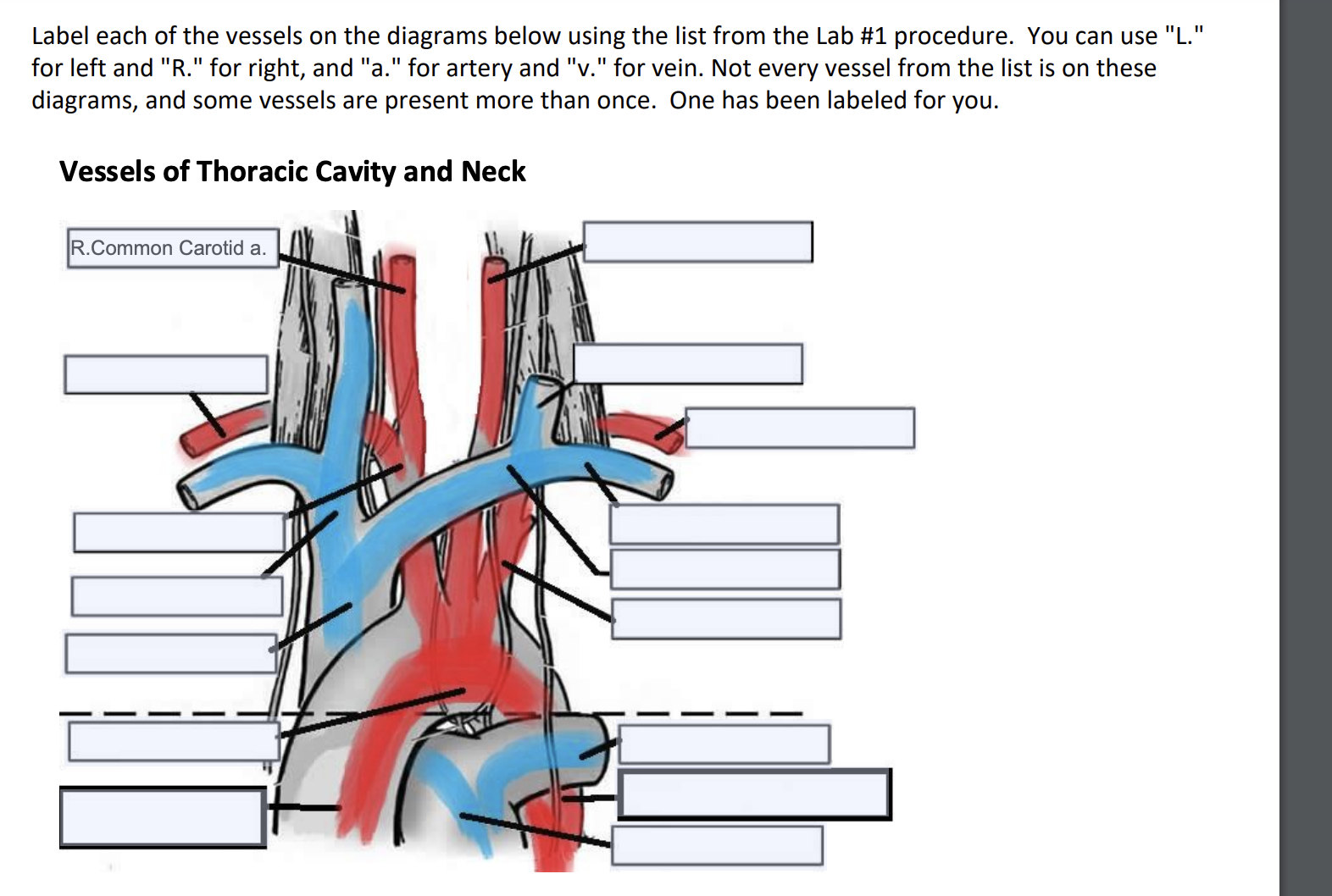 Solved Label each of the vessels on the diagrams below using | Chegg.com