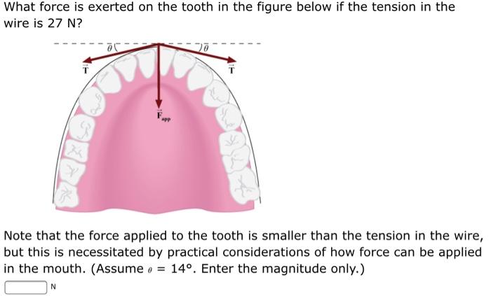 Solved What force is exerted on the tooth in the figure | Chegg.com