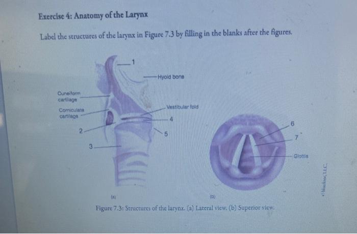 Exercisc 4: Anatomy of the Larynx Label the | Chegg.com