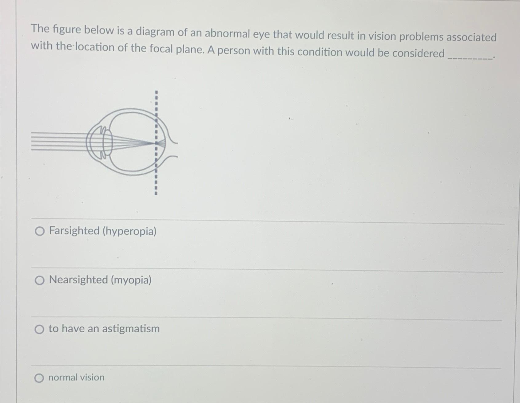 Solved The figure below is a diagram of an abnormal eye that | Chegg.com