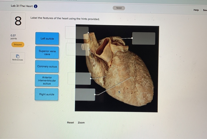 Solved Lab 3 1 The Heart Saved Help Sav Label The Features