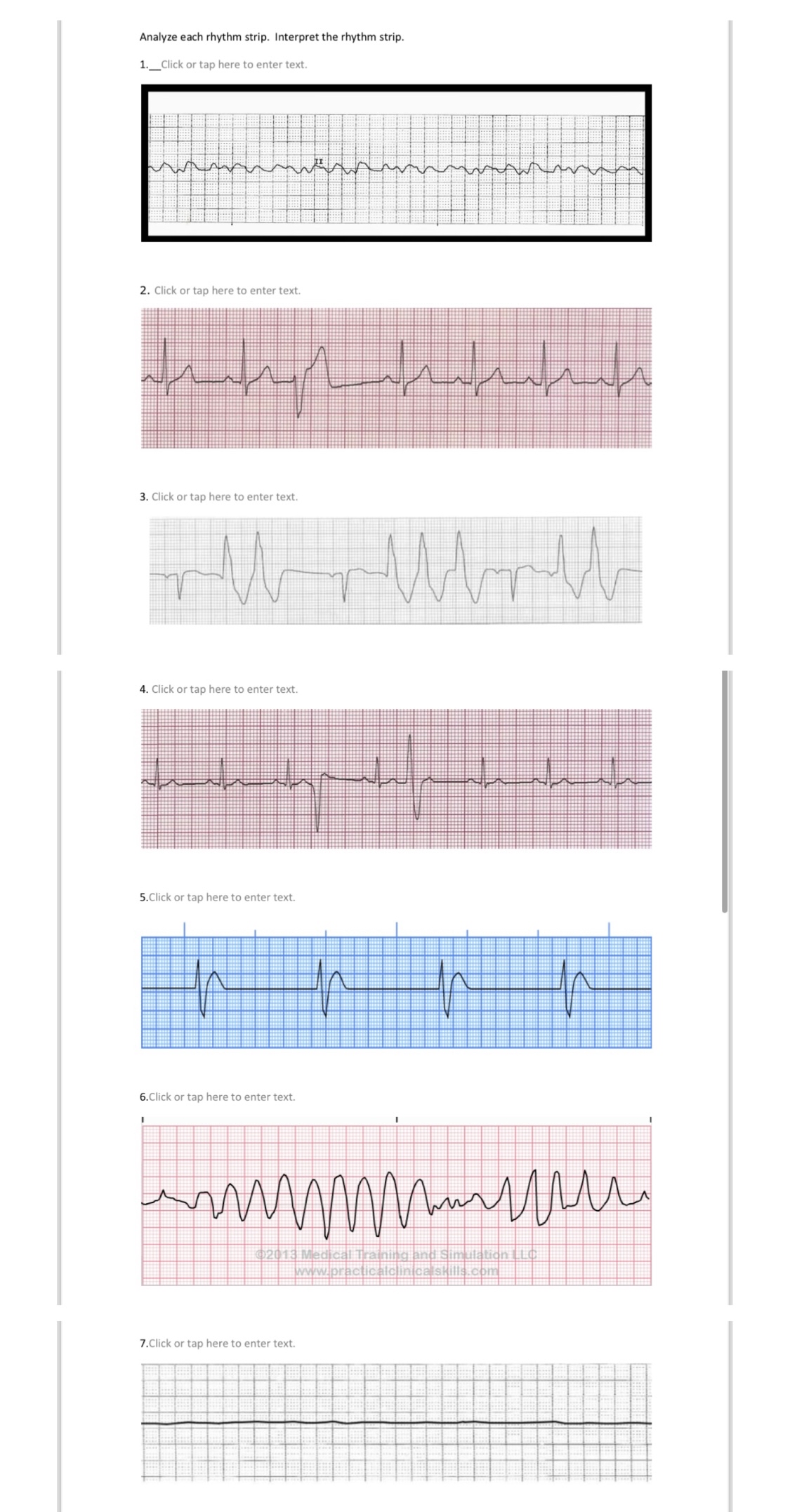 Solved Analyze each rhythm strip. Interpret the rhythm | Chegg.com