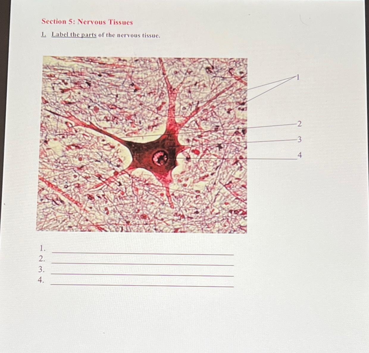Solved Section 5: Nervous TissuesLabel the parts of the | Chegg.com