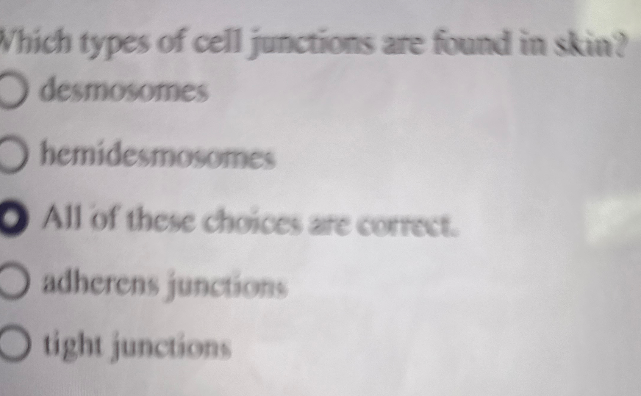 Solved Which types of cell junctions are found in | Chegg.com