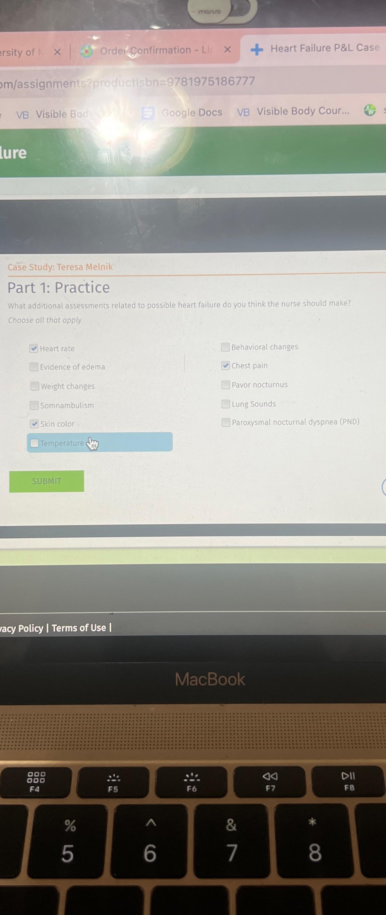 Solved Heart Failure P&L CaseVB Visible BodGoogle | Chegg.com