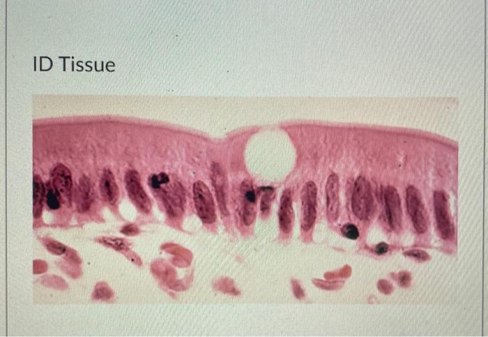 Solved ID Tissue | Chegg.com