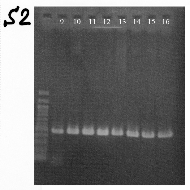 Solved We did a lab for DNA sequencing and my number is 12. | Chegg.com