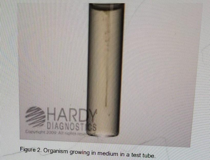 Solved Figure 1. Three types of media in test tubes. HARDY | Chegg.com