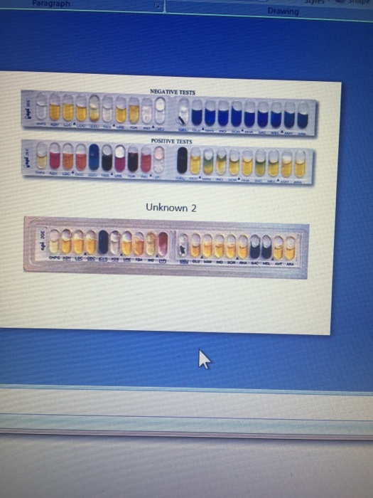 Exercise 8 Use of the API 20E System to Identify Gram | Chegg.com