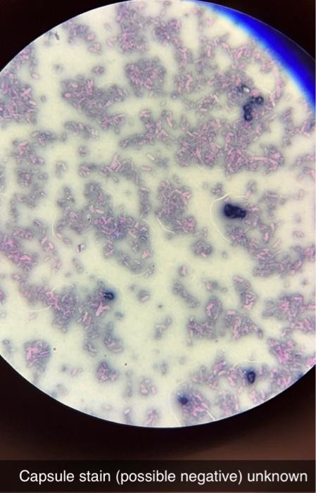 Solved Capsule stain (possible negative) unknown | Chegg.com