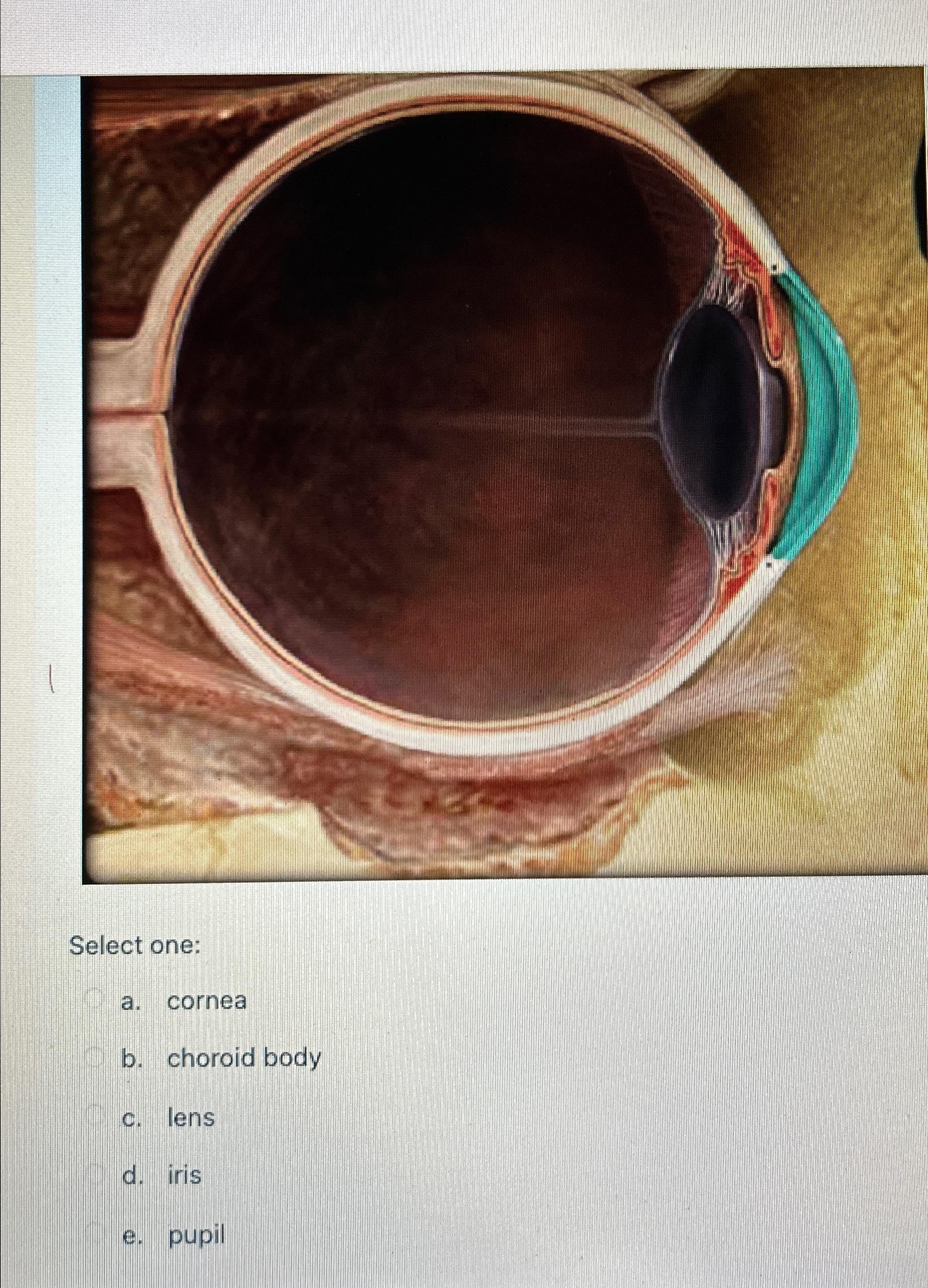 Identify the structure highlighted jn BLUE Select | Chegg.com