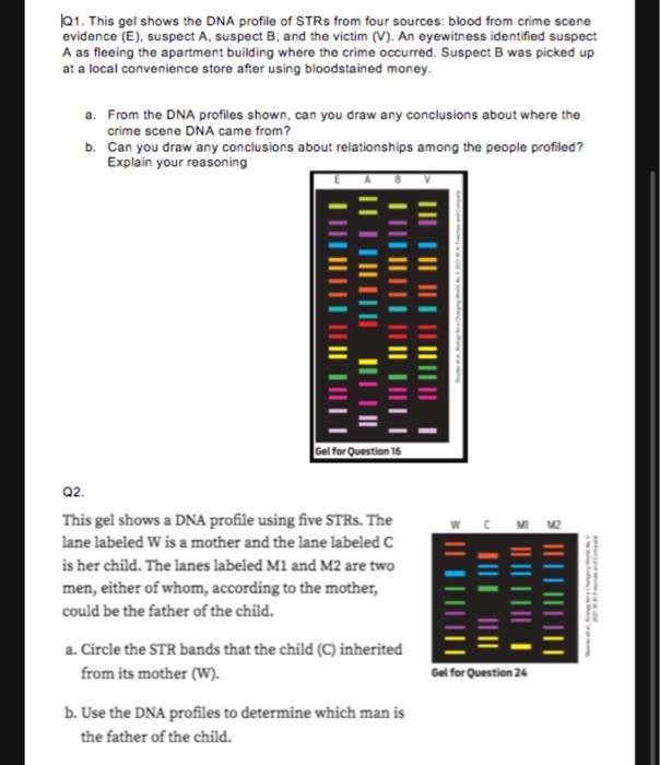 Solved Q1. This gel shows the DNA profile of STRs from four | Chegg.com