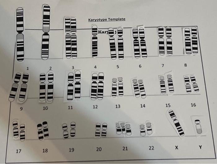 Solved compair the karyotype to the chromosomal disorder | Chegg.com