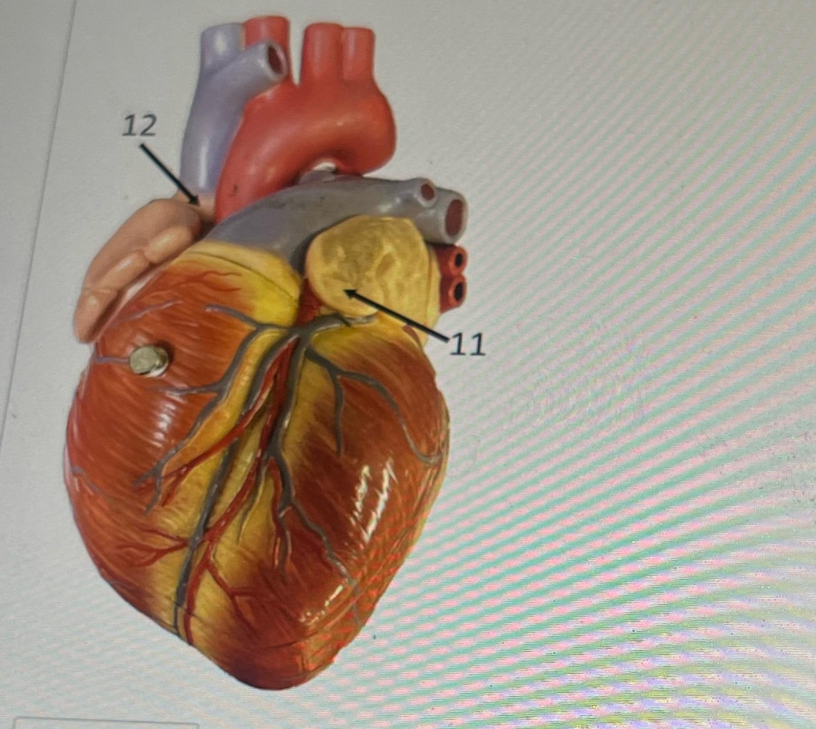 Solved Lable parts of heart | Chegg.com