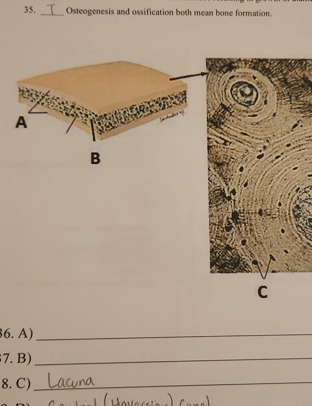 Solved 35. T Osteogenesis and ossification both mean bone | Chegg.com