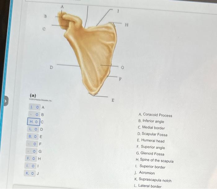 Solved A. Coracoid Process B. Inferior angle C. Medial | Chegg.com