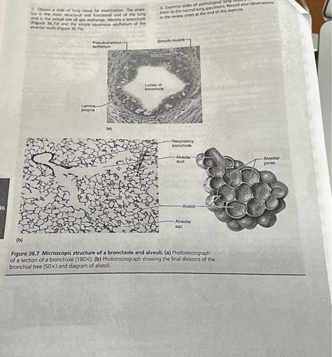 Solved Examining Prepared Slides of Trachea and Lung Tissue | Chegg.com
