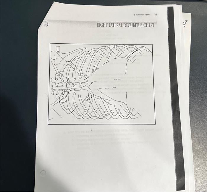 Solved RIGHT LATERAL DECUBITUS CHEST | Chegg.com