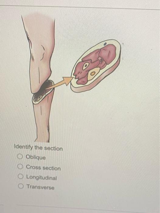 Solved Identify the section Oblique Cross section | Chegg.com