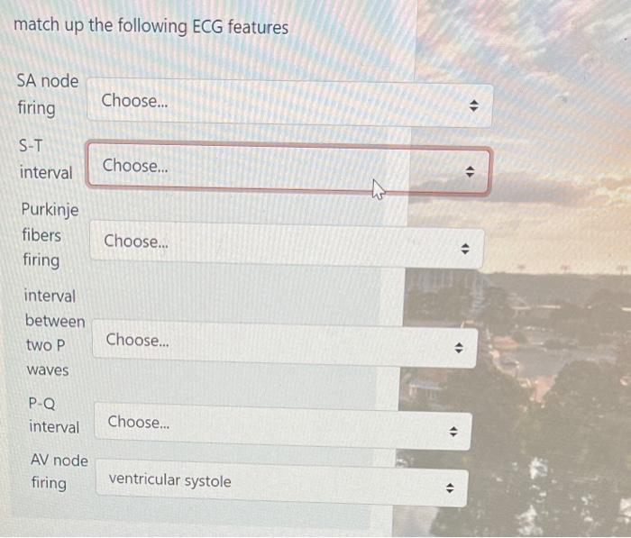 Solved match up the following ECG features SA node firing | Chegg.com