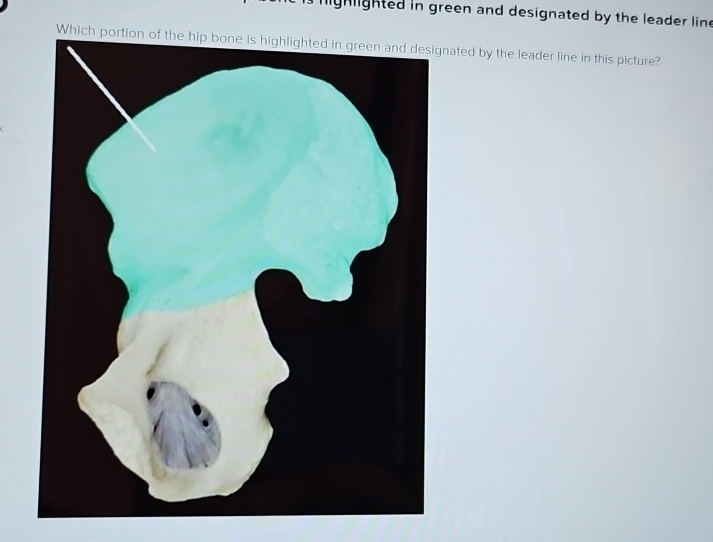 Solved Which portion of the hip bone is highlighted in green | Chegg.com