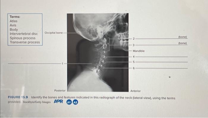 Solved (bone) (bone) landible enior FIGURE 15.9 Identify the | Chegg.com