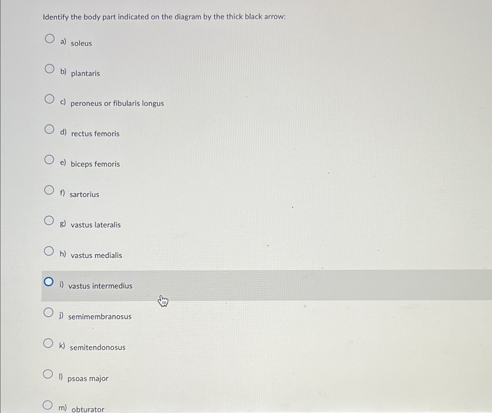 Solved Identify the body part indicated on the diagram by | Chegg.com