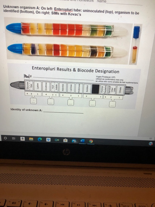 Solved UMOWI Wang Unknown organism A: On left: Enteropluri | Chegg.com